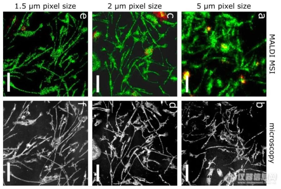 质谱新技术-质谱成像技术TransMIT AP-SMALDI_仪器信息网社区